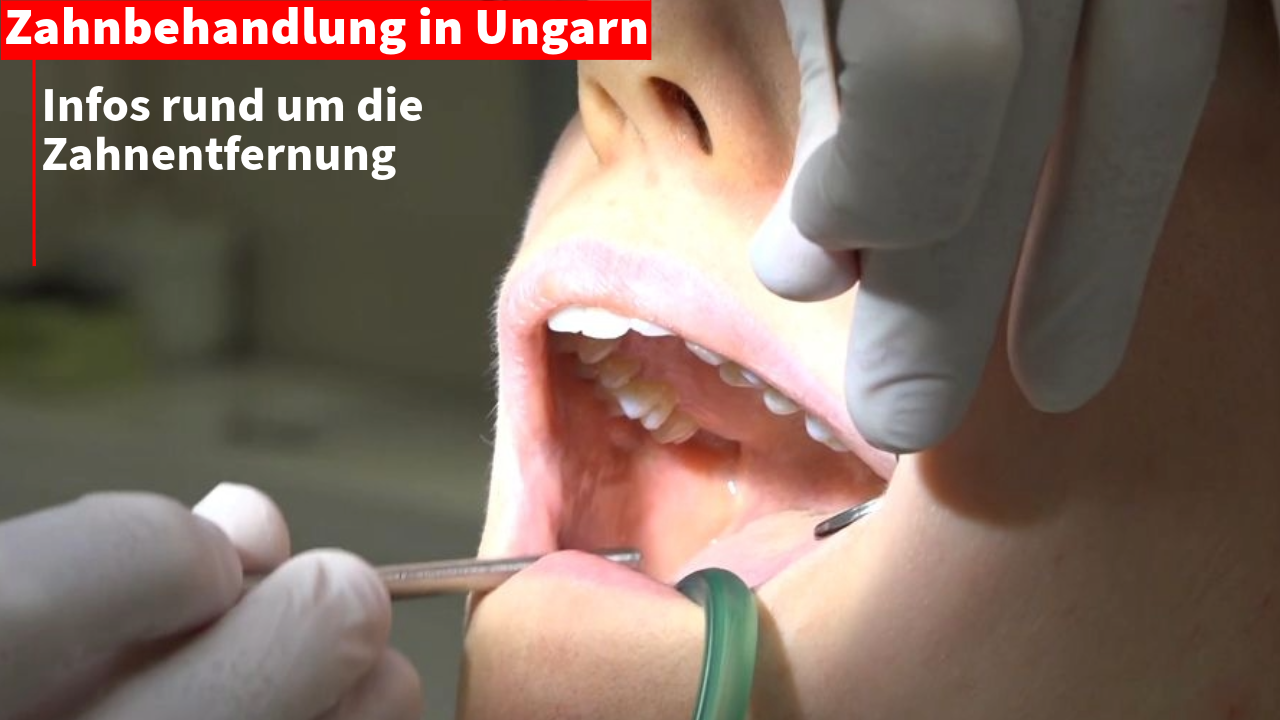 Ungarische Zahnbehandlung: Tipps zur Zahnentfernung | Ungarn-TV.com ...
